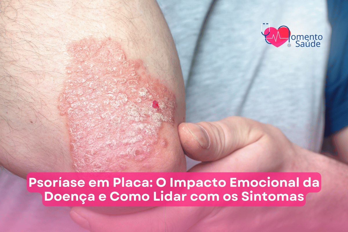 Psoríase em Placa: O Impacto Emocional da Doença e Como Lidar com os ...
